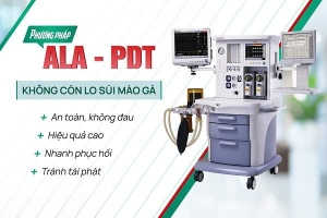 ALA-PDT Trong điều Trị Sùi Mào Gà ứng Dụng Và Hiệu Quả